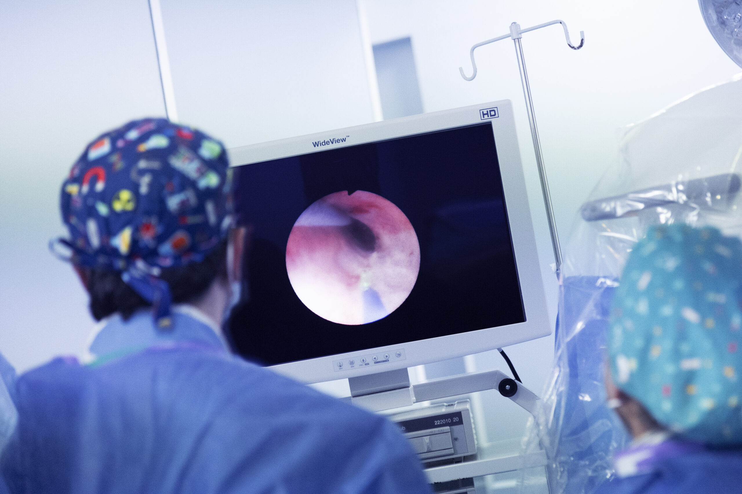 Cirugía endoscópica de litiasis y vejiga - Apexurologia